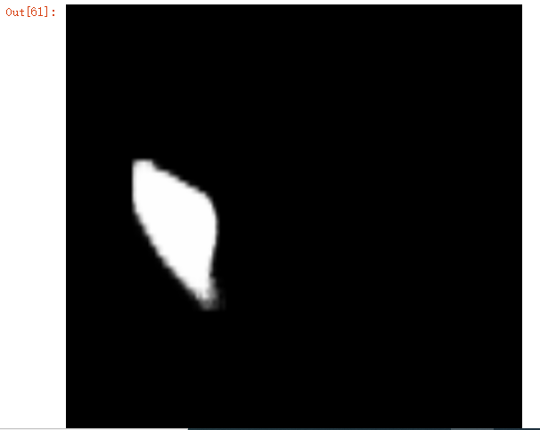 Mask R-CNN的PyTorch实现（医学图像上的应用）_mask rcnn医学-CSDN博客