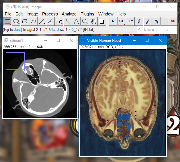 [Anaconda]Simple itk调用ImageJ/fiji | sitk.Show(image)_调用fiji-CSDN博客