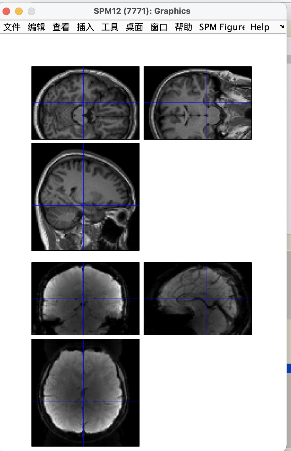 学习笔记｜fmri_4 预处理 co- register segment normalize smooth SPM12_co-registration-CSDN博客