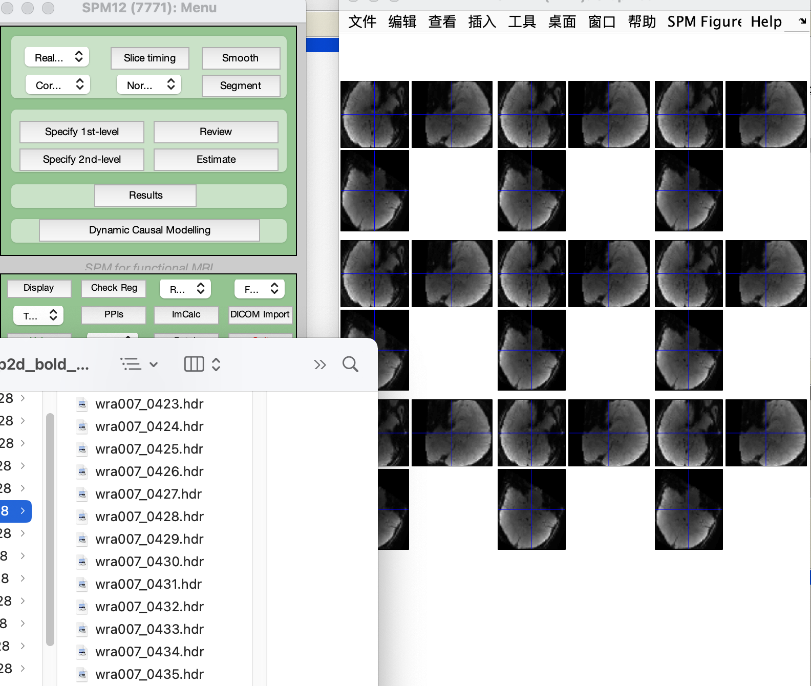 学习笔记｜fmri_4 预处理 co- register segment normalize smooth SPM12_co-registration-CSDN博客