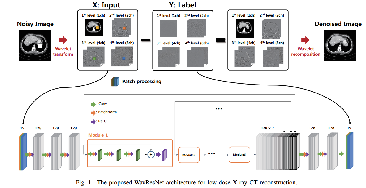 《Low-Dose CT》去噪论文_redcnn-CSDN博客