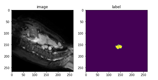 使用MONAI深度学习框架进行3D图像空间变换_monai randaffine参数设置-CSDN博客