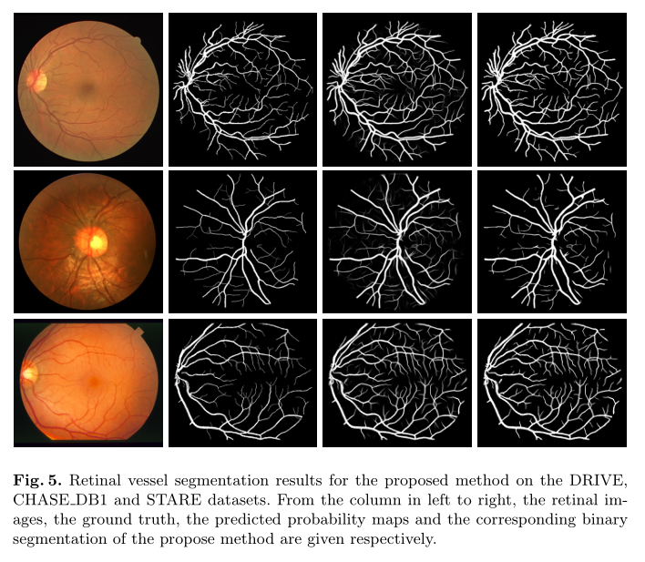 论文阅读——Boosting Connectivity in Retinal Vessel Segmentation via a ...