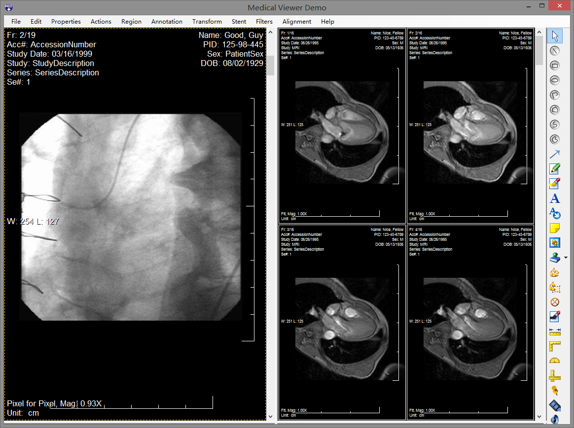 Dicom3DSDk之dicomobjects the Crack_dicomobjects crack-CSDN博客