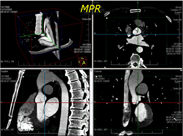 Dicom3DSDk之dicomobjects the Crack_dicomobjects crack-CSDN博客