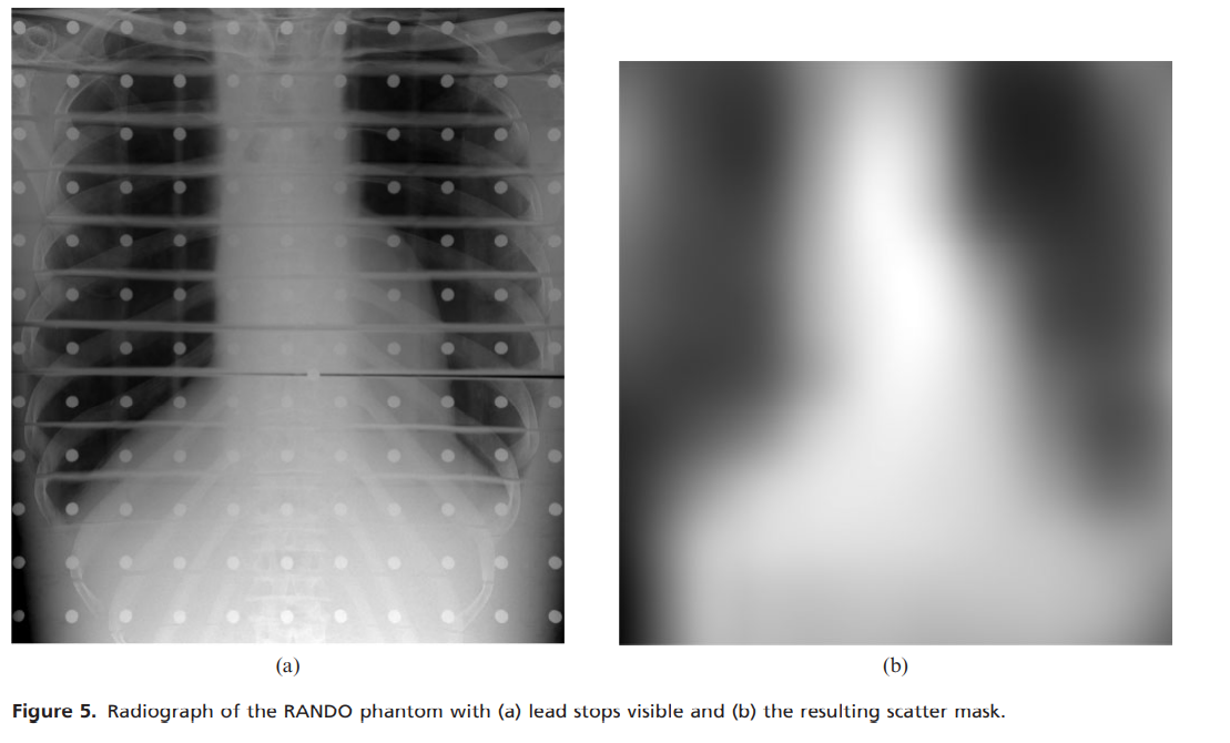 一种生成和验证基于DRR算法的用于优化使用计算机放射成像系统获得的胸片的计算机模拟方法_x射线 散射 估计-CSDN博客