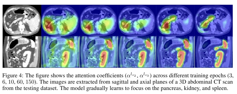 【论文翻译-3】Attention U-Net: Learning Where to Look for the Pancreas-CSDN博客
