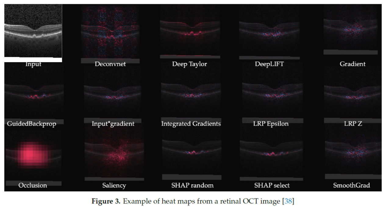 Explainable deep learning models in medical image analysis【谷歌翻译】-CSDN博客