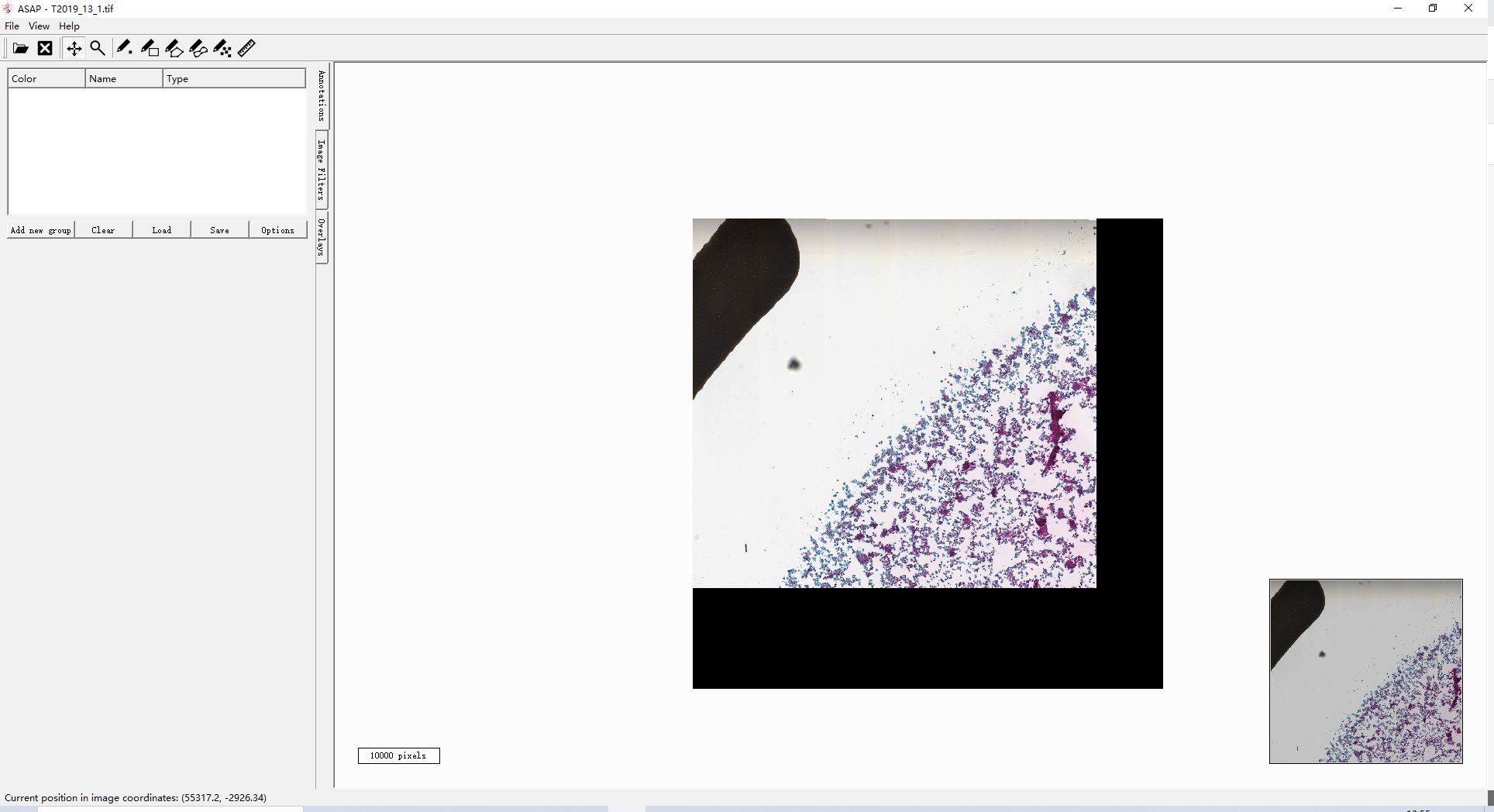 kfb转tif后信息丢失的解决方案_kfb文件怎么打开-CSDN博客