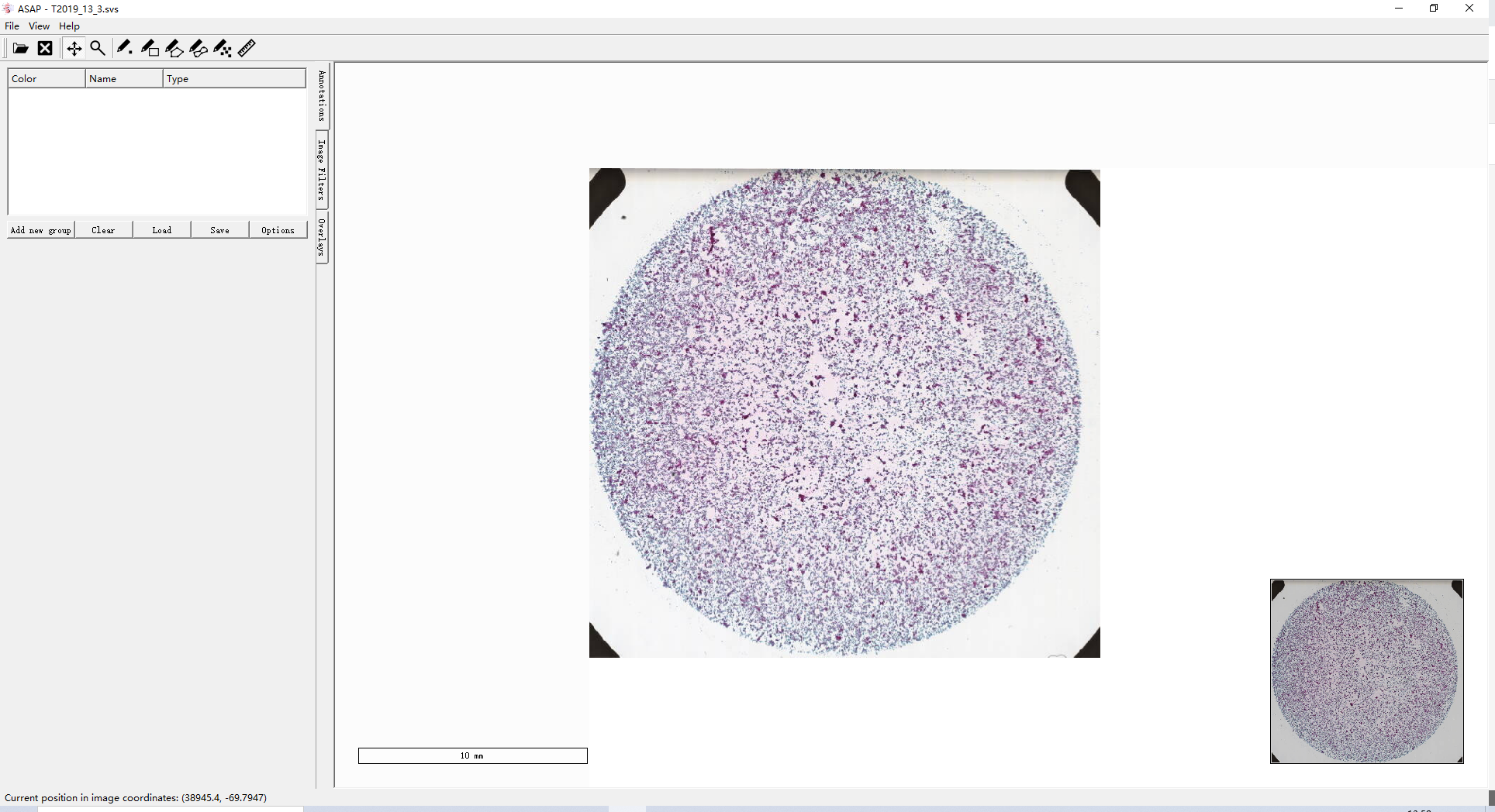 kfb转tif后信息丢失的解决方案_kfb文件怎么打开-CSDN博客