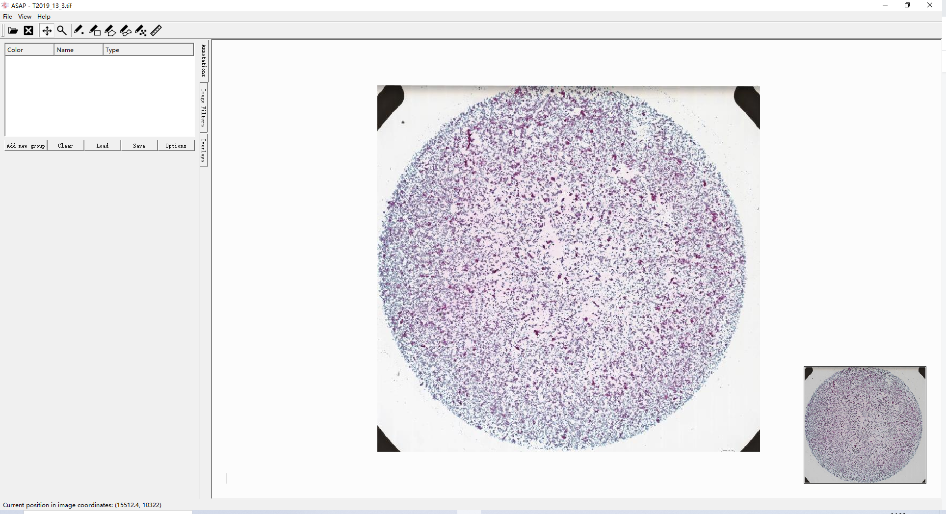kfb转tif后信息丢失的解决方案_kfb文件怎么打开-CSDN博客
