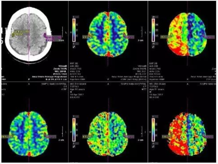 CTP资料_ctp怎么看-CSDN博客