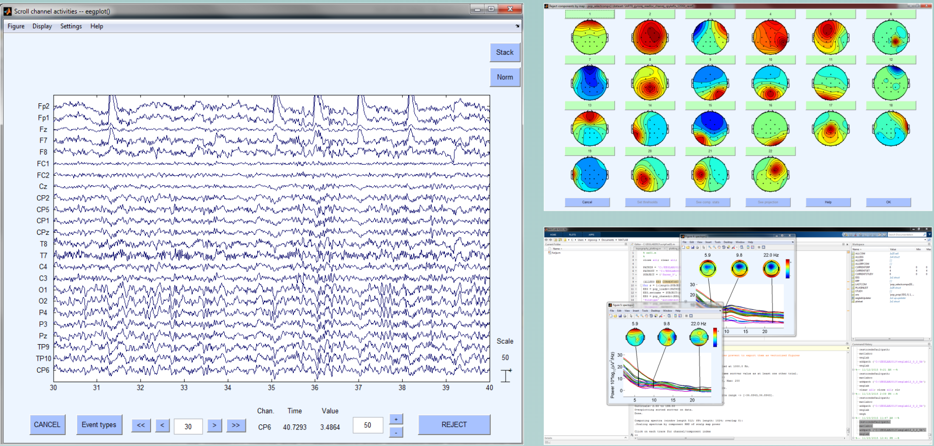 Smarting：第一款真正意义上的便携式可移动脑电设备_identifying auditory attention with ear-eeg: ceegr-CSDN博客