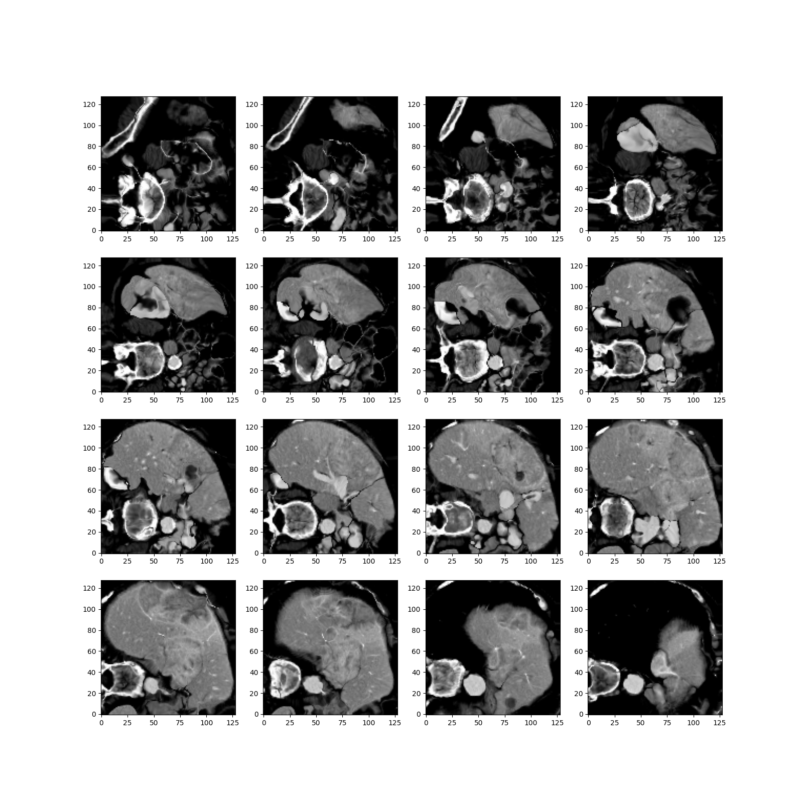ICCV2019《Recursive Cascaded Networks for Unsupervised Medical Image Registration》代码学习_lpba数据-CSDN博客
