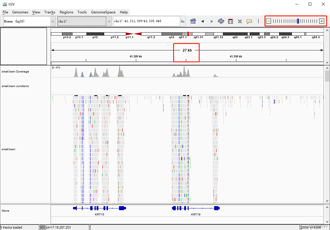 肿瘤外显子数据分析 -- 20201119_wes数据库-CSDN博客