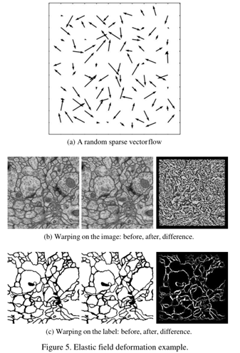 FusionNet:A deep fully residual convolutional neural network for image segmentation in ...