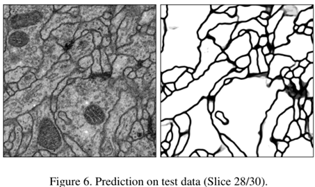 FusionNet:A deep fully residual convolutional neural network for image segmentation in ...