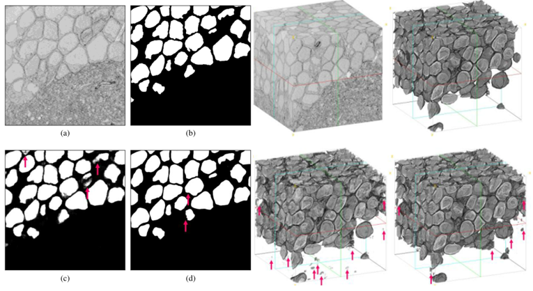 FusionNet:A deep fully residual convolutional neural network for image segmentation in ...