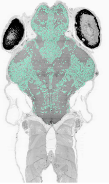 FusionNet:A deep fully residual convolutional neural network for image segmentation in ...