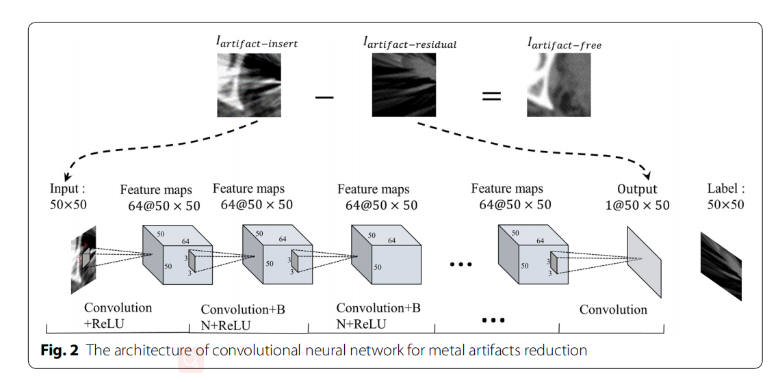 深度学习——Metal artifact reduction_金属伪影数据集-CSDN博客