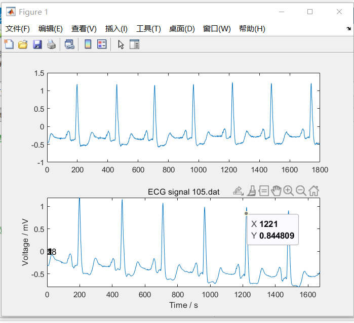 MATLAB中实现ECG数据降噪代码部分设计_添加50赫兹电源线噪声和基线漂移-CSDN博客