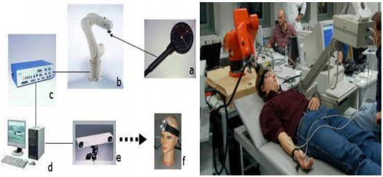 Robotic TMS（二）：机器人辅助TMS治疗系统_robodoc机器人-CSDN博客