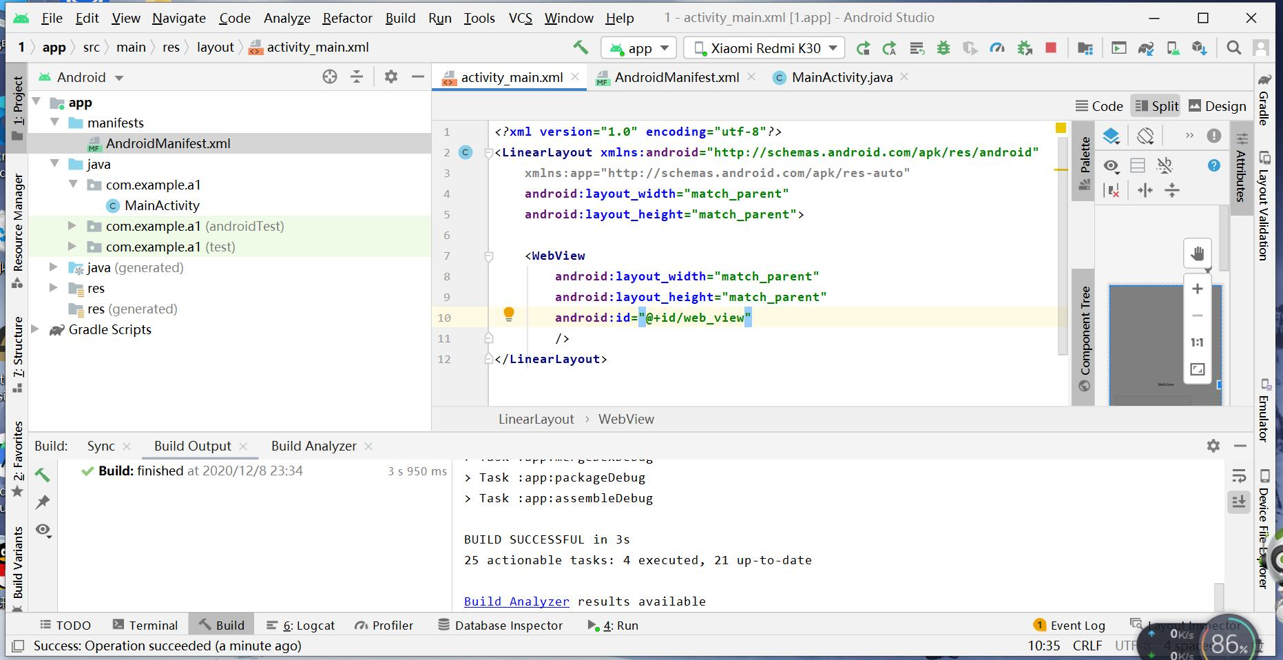 C:\Users\86131\.gradle\caches\transforms-2\files-2.1\6753cd877c1ba9dbc8b7c64e227cb479\transition ...
