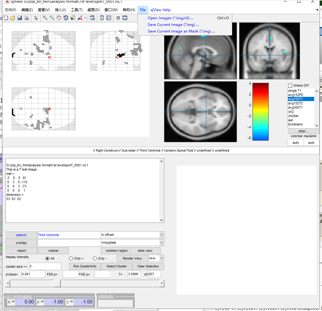 fmri|学习笔记 1st level analysis和xjview_1stlevel-CSDN博客