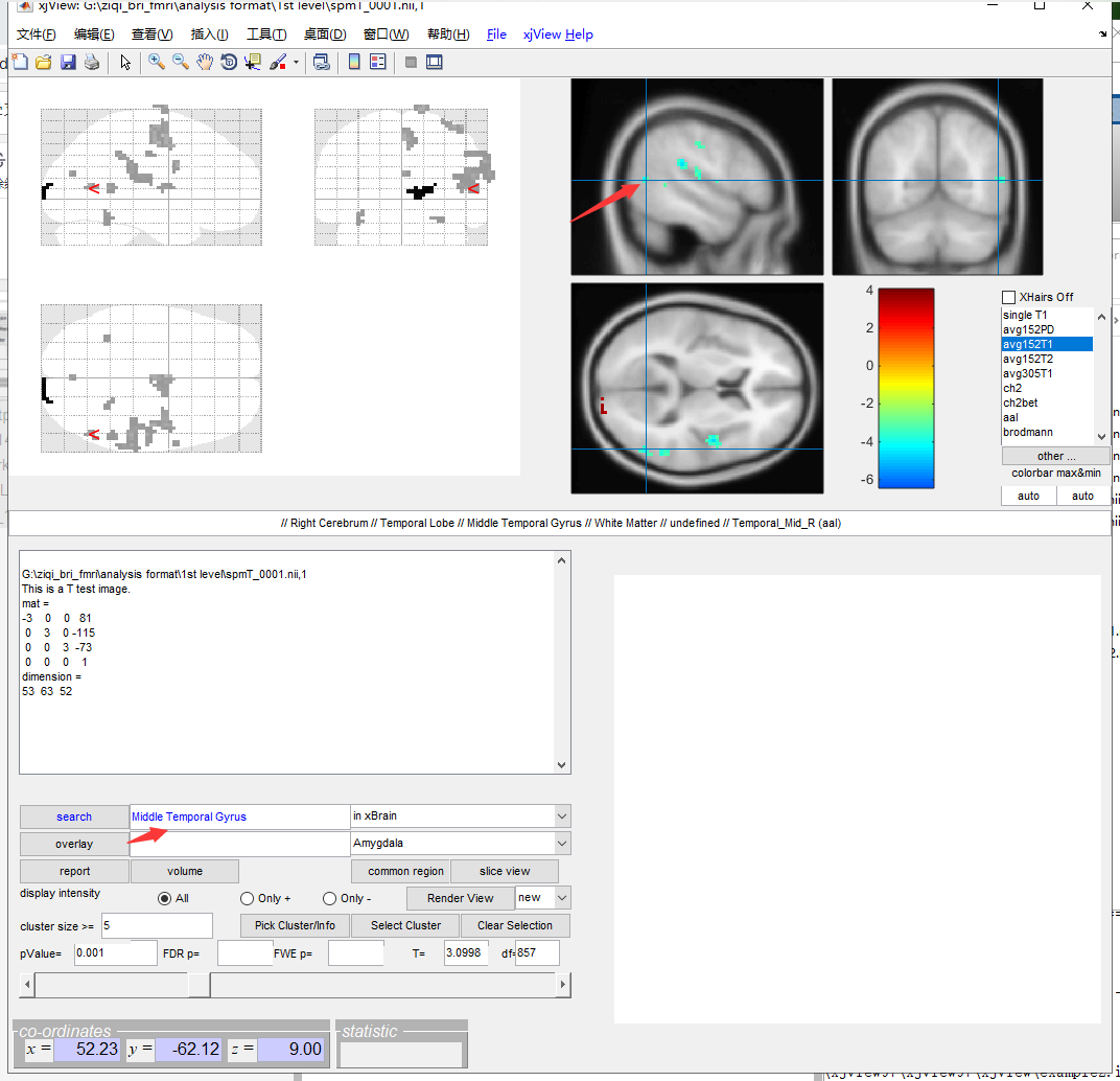fmri|学习笔记 1st level analysis和xjview_1stlevel-CSDN博客