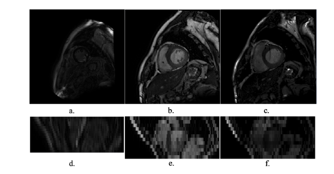 【论文学习】An Automatic Cardiac Segmentation Framework based on Multi ...