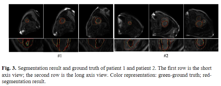 【论文学习】An Automatic Cardiac Segmentation Framework based on Multi-sequence MR Image_ms-cmrseg 数据集 ...