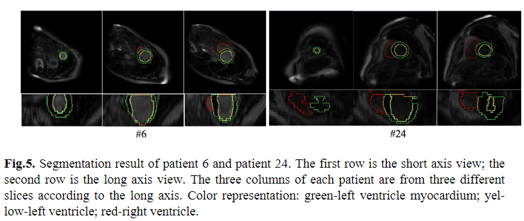 【论文学习】An Automatic Cardiac Segmentation Framework based on Multi-sequence MR Image_ms-cmrseg 数据集 ...