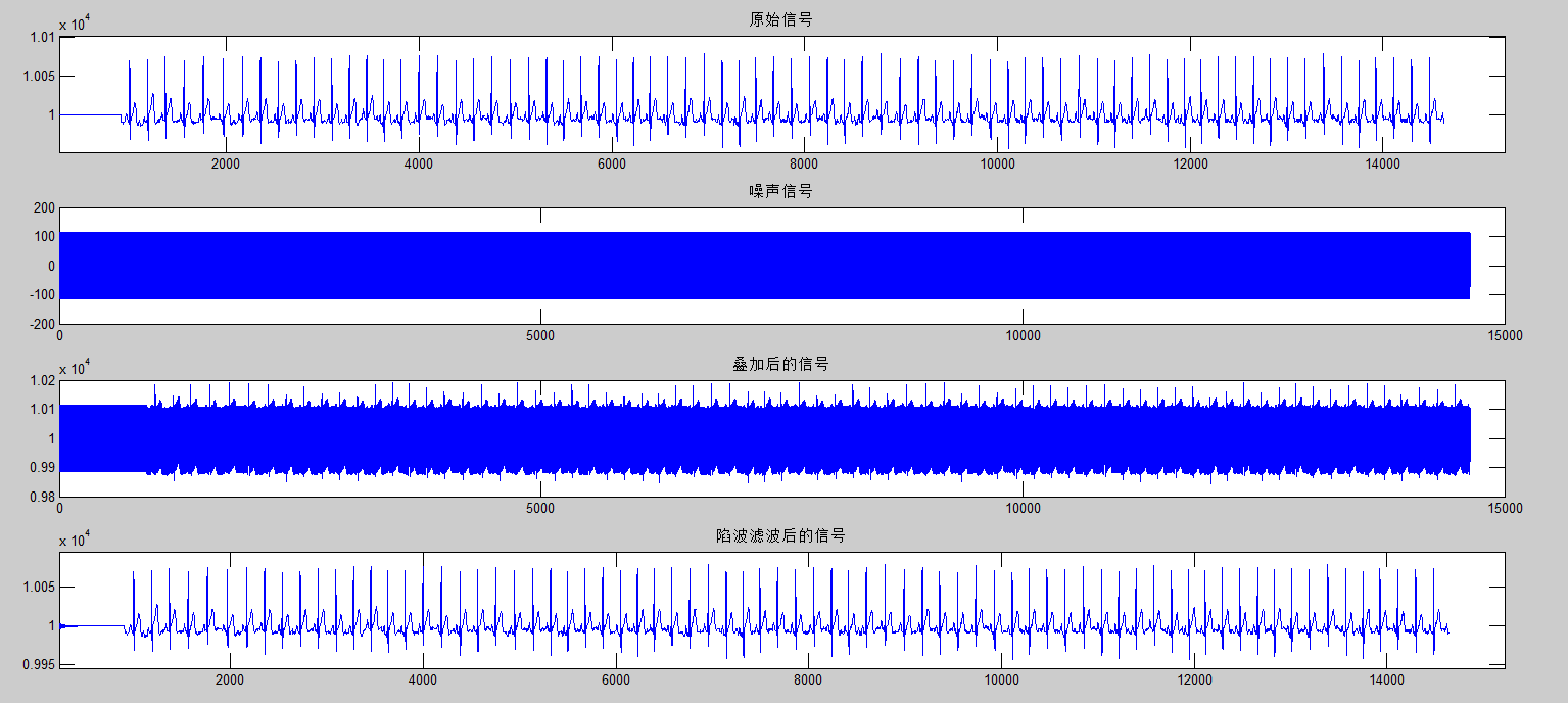 心电图ECG常用滤波器之陷波器_陷波器ecg-CSDN博客
