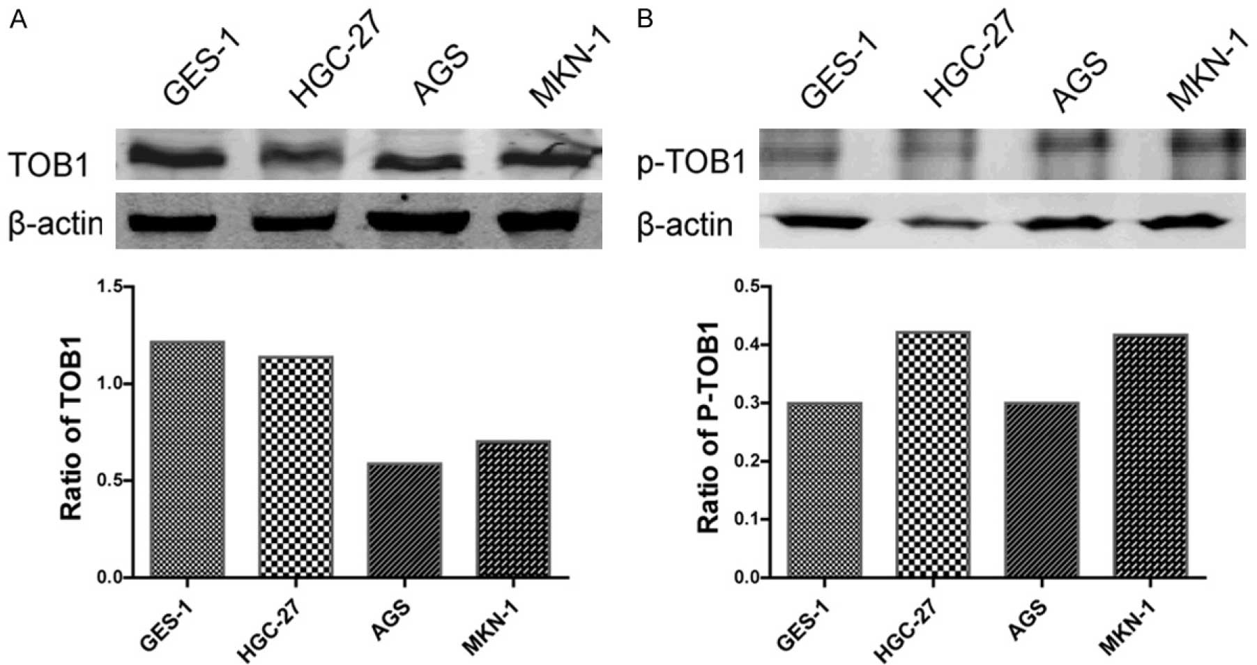 TOB1在T172和S320位点的磷酸化对胃癌的增殖和进展至关重要_磷酸化t228位点-CSDN博客