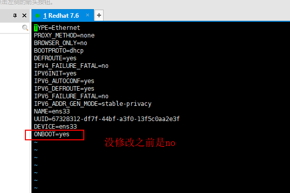 Redhat 7.6 终端输入ifconfig没有ip地址_relhat 输入ifconfig没有ip-CSDN博客