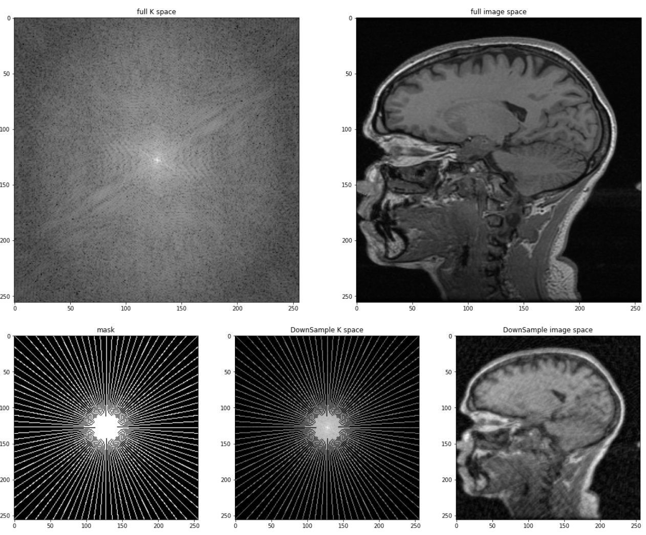 使用 CC-359 数据集进行 MRI 重建（二）_核磁共振mask模板-CSDN博客