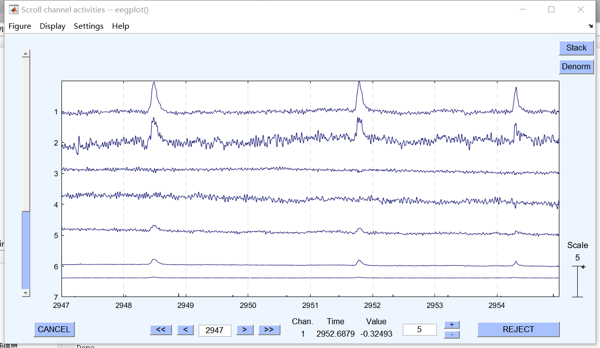 EEGLAB 脑电数据处理与分析_eeglab中怎么样进行特征分析-CSDN博客