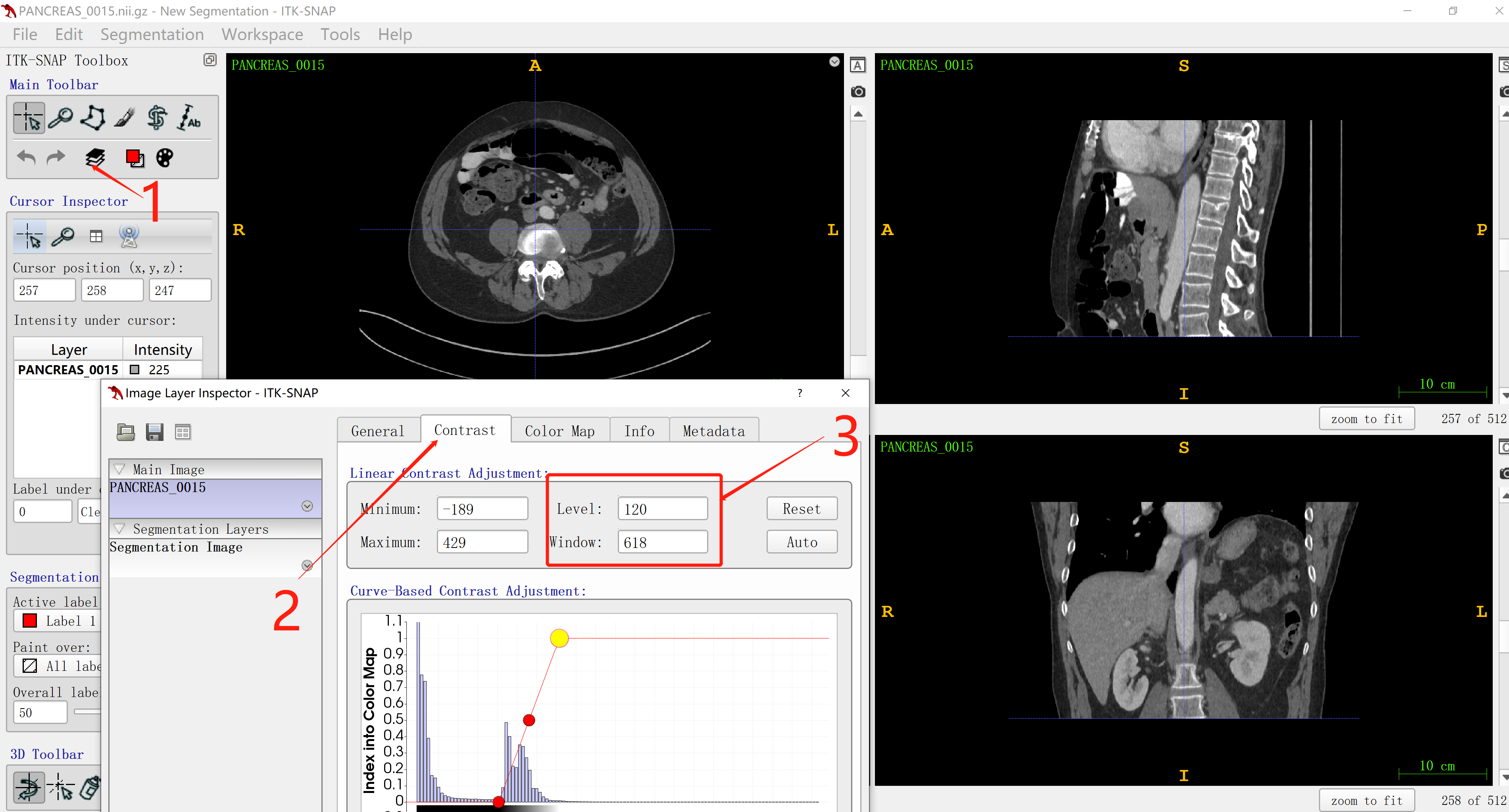 医学图像预处理之可视化_如何可视化nii.gz文件-CSDN博客