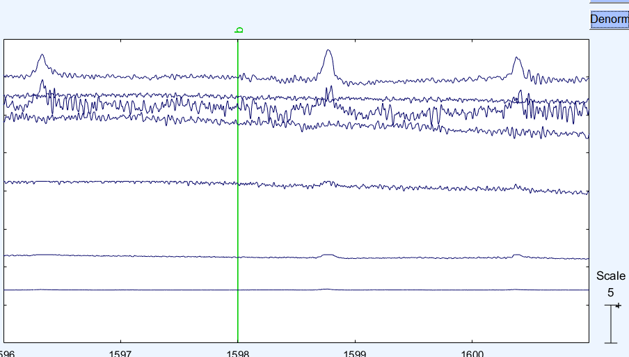 EEGLAB 脑电数据处理与分析_64路采集得eeg信号为什么eeglab上显示65channel-CSDN博客
