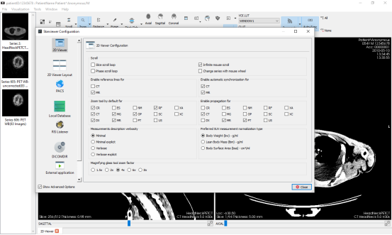 【2021-01-05 更新版】简易PACS系统模拟搭建（仅供参考学习）_zyq1569的博客-CSDN博客