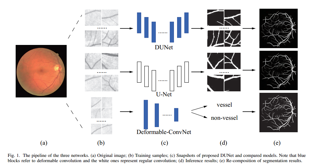 UNet变体-CSDN博客
