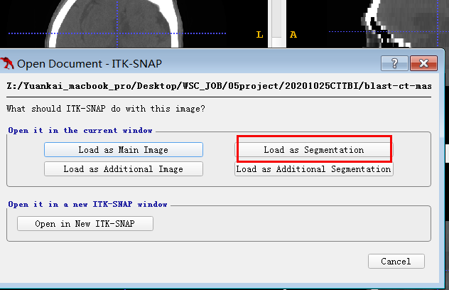 ITK-SNAP的使用_snap segmentation可以重复利用吗-CSDN博客
