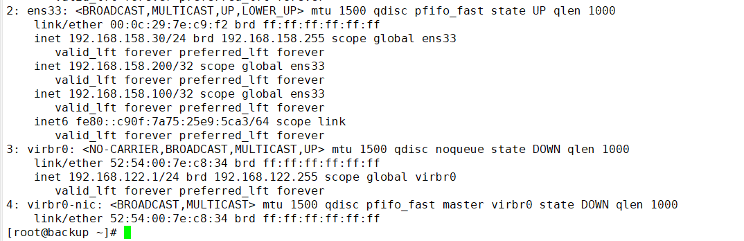 学会Haproxy+Keepalived实现高可用负载均衡项目搭建一片就够了！！！_keepalived配合haproxy在游戏项目中的拓扑图-CSDN博客