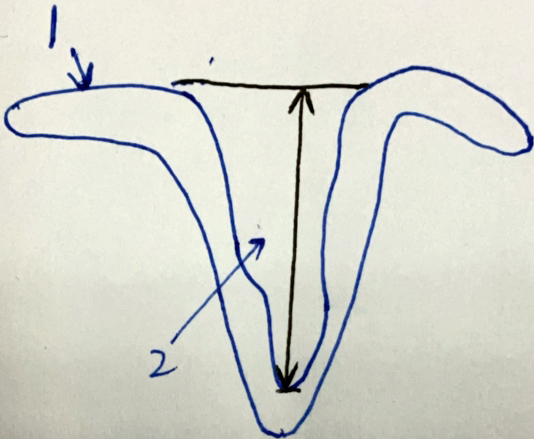 基于cat12和SPM12进行SBM数据分析笔记_基于cat12和spm12进行vbmsbm数据分析笔记2-CSDN博客