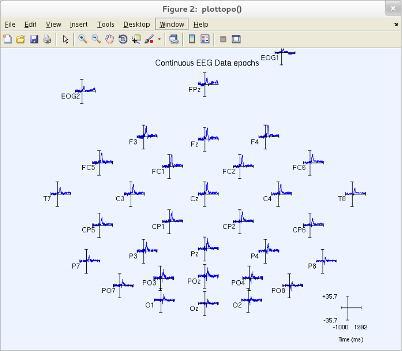 EEGLAB合辑 | 第五节 数据平均_BCIduino脑机接口社区的博客-CSDN博客
