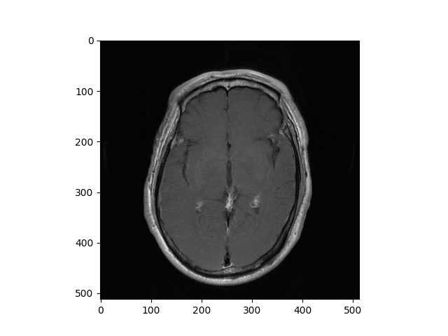 医学图像python之dicom图像显示_python 读dicom数据并显示图像-CSDN博客