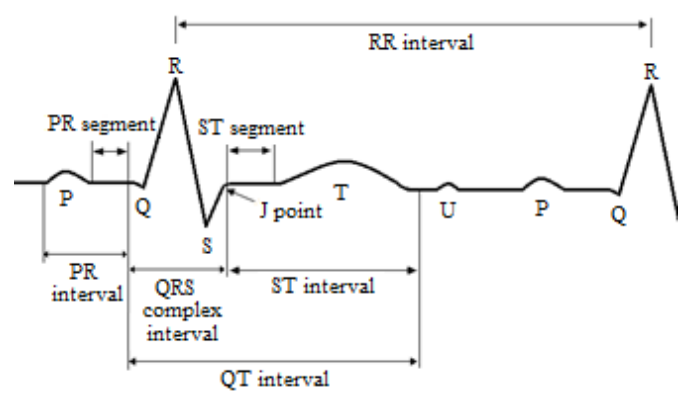 论文阅读笔记（1）---Classification of ECG signals using Machine Learning ...