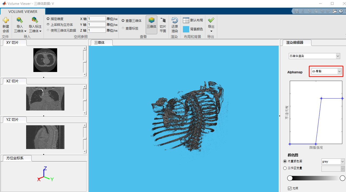 基于Matlab的3-D胸部扫描CT切片的肺部分割——使用活动轮廓(snakes)进行三维分割及建模_肺部ct 3d建模-CSDN博客