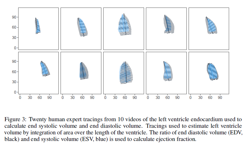 EchoNet-Dynamic超声心动数据集-CSDN博客