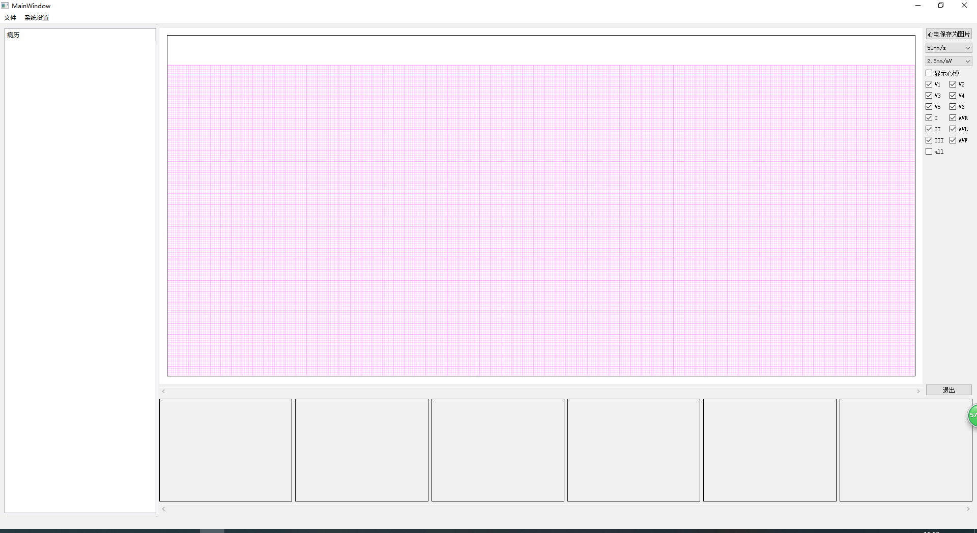 Qt开发之心电显示项目实现_qcustomplot 心电图-CSDN博客